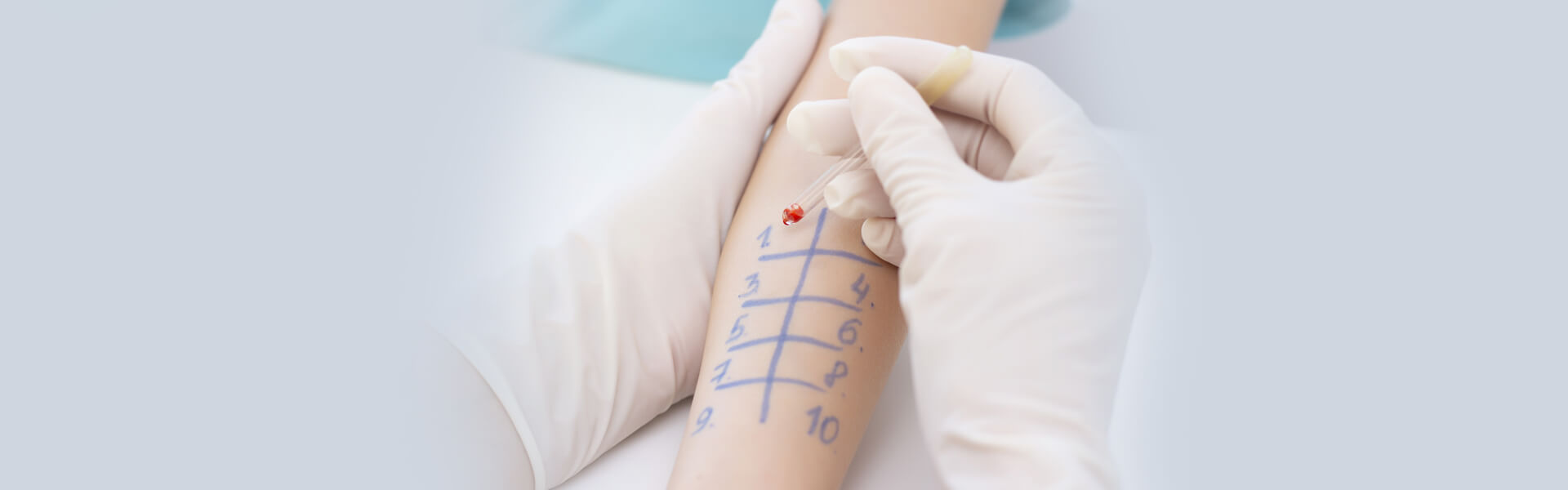 Allergy Testing Treatment Explained